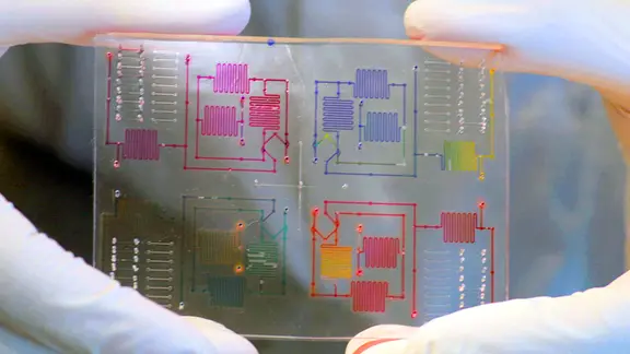 PCR-Tests teuer und knapp: Alternative Corona-Tests aus Dresden | mdr.de